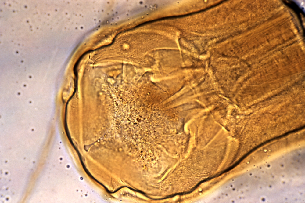 photomicrograph-depicts-the-mouth-parts-hookworm-larvae - Classroom ...