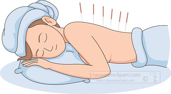 woman with acupuncture needles during therapy clipart - Classroom Clip Art