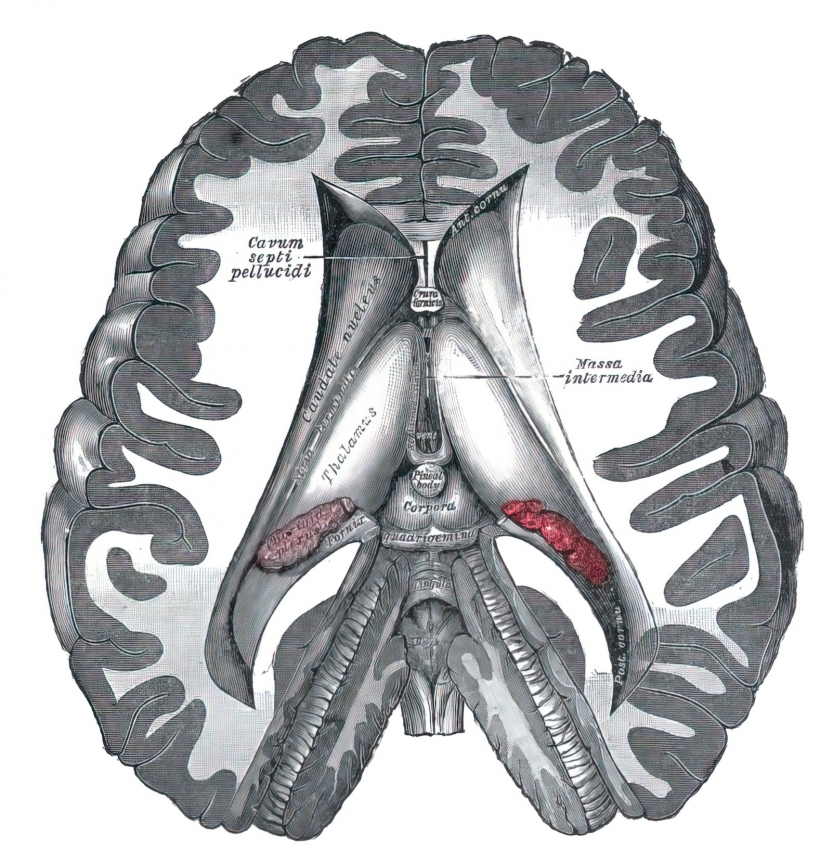 dissection showing ventricles of brain human anatomy - Classroom Clip Art