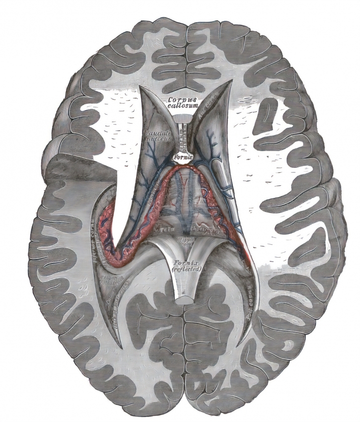tela chorioidea of third ventricle human anatomy - Classroom Clip Art